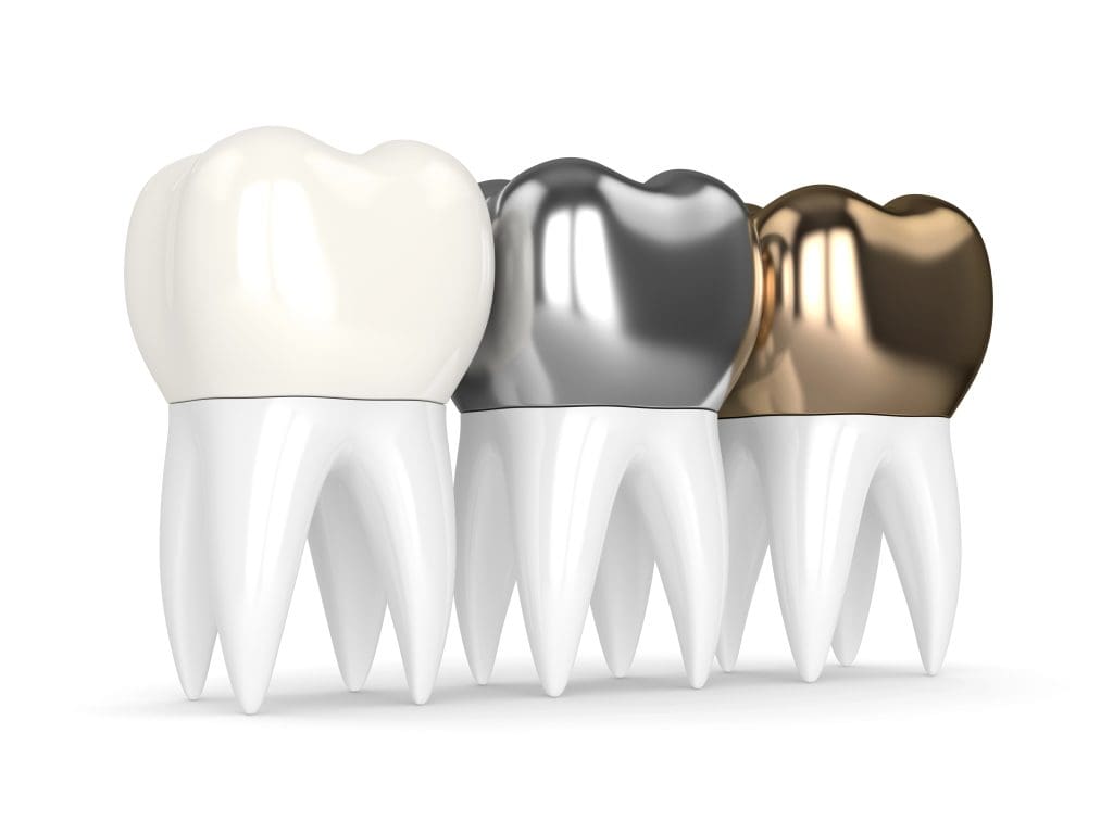 Dental Crown vs Bridge: Choosing the Right Option for Missing or ...